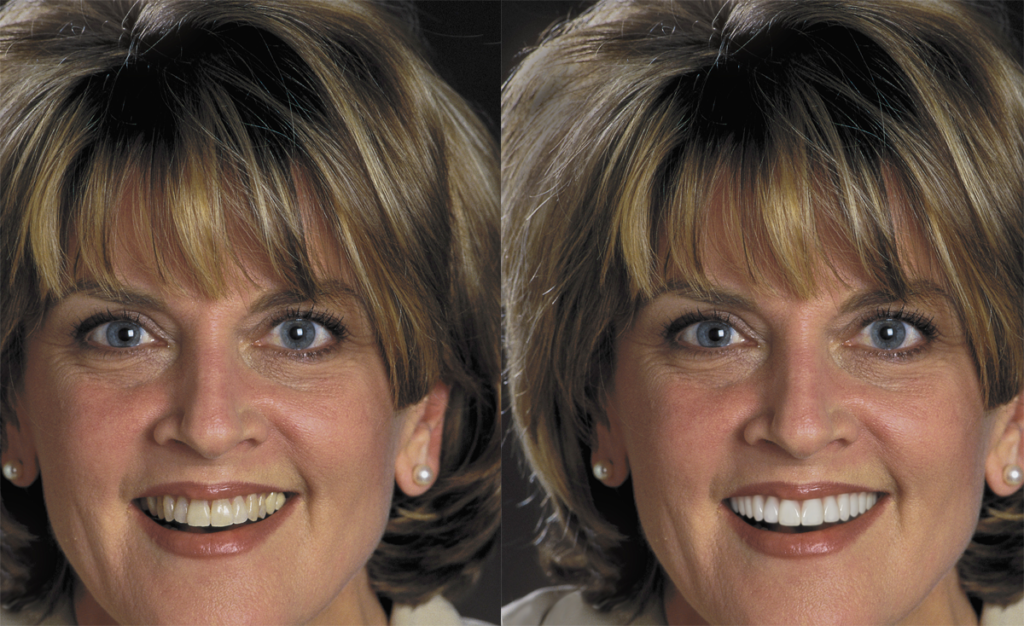 Focused Marketing | Smile-Vision